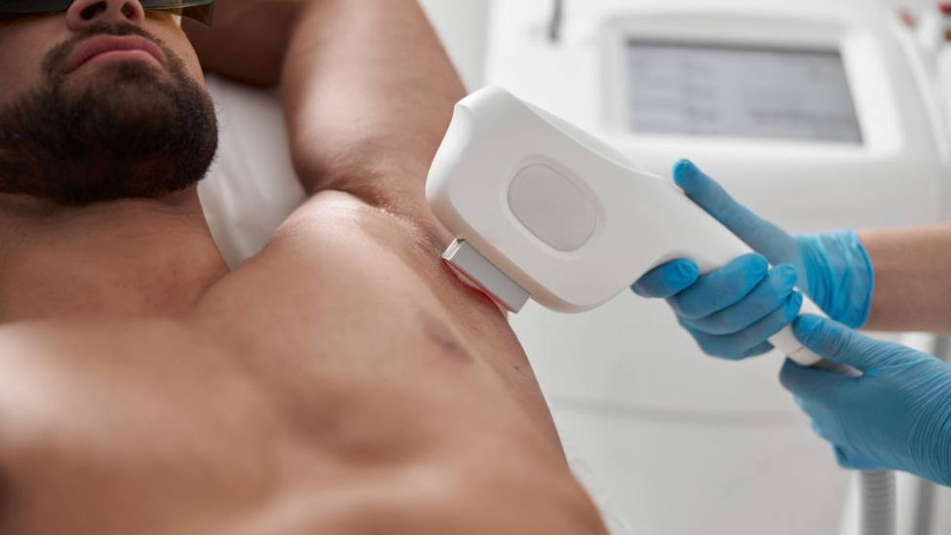 Depilaci n L ser Masculina SinVello La Soluci n Definitiva Para Hombres